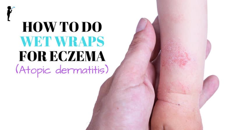 How to do wet wraps for eczema (atopic dermatitis) - Montana Whole Health